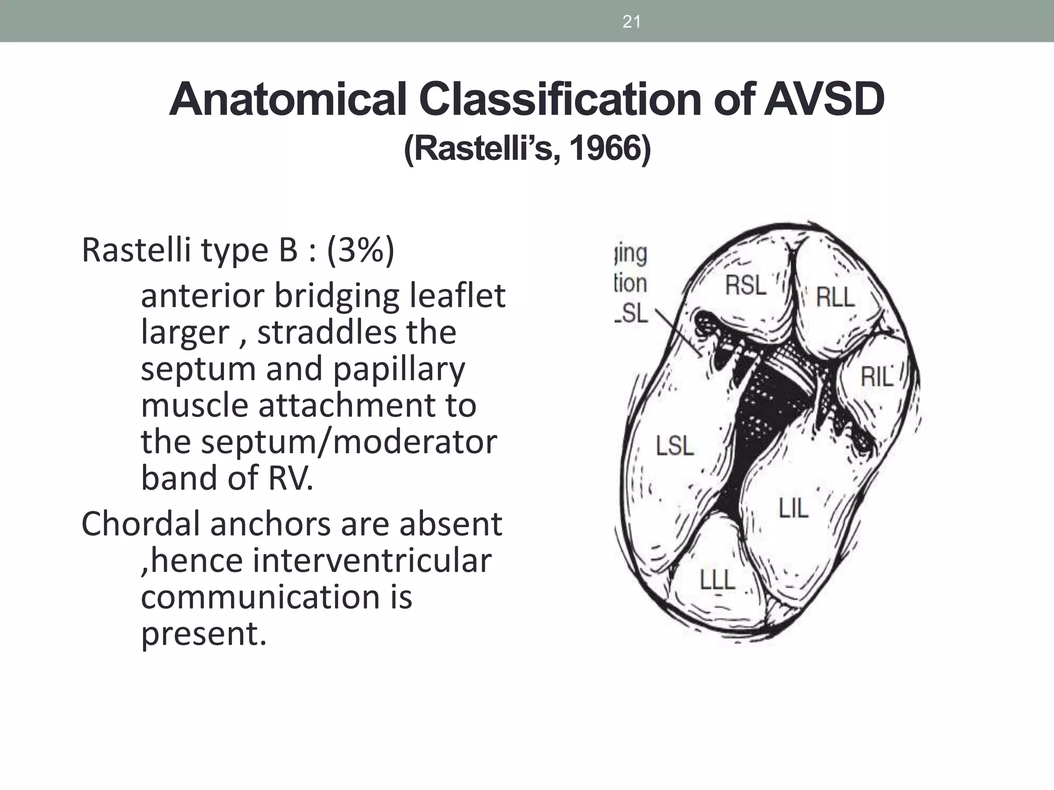 Atrioventricular septal defects | PPTX
