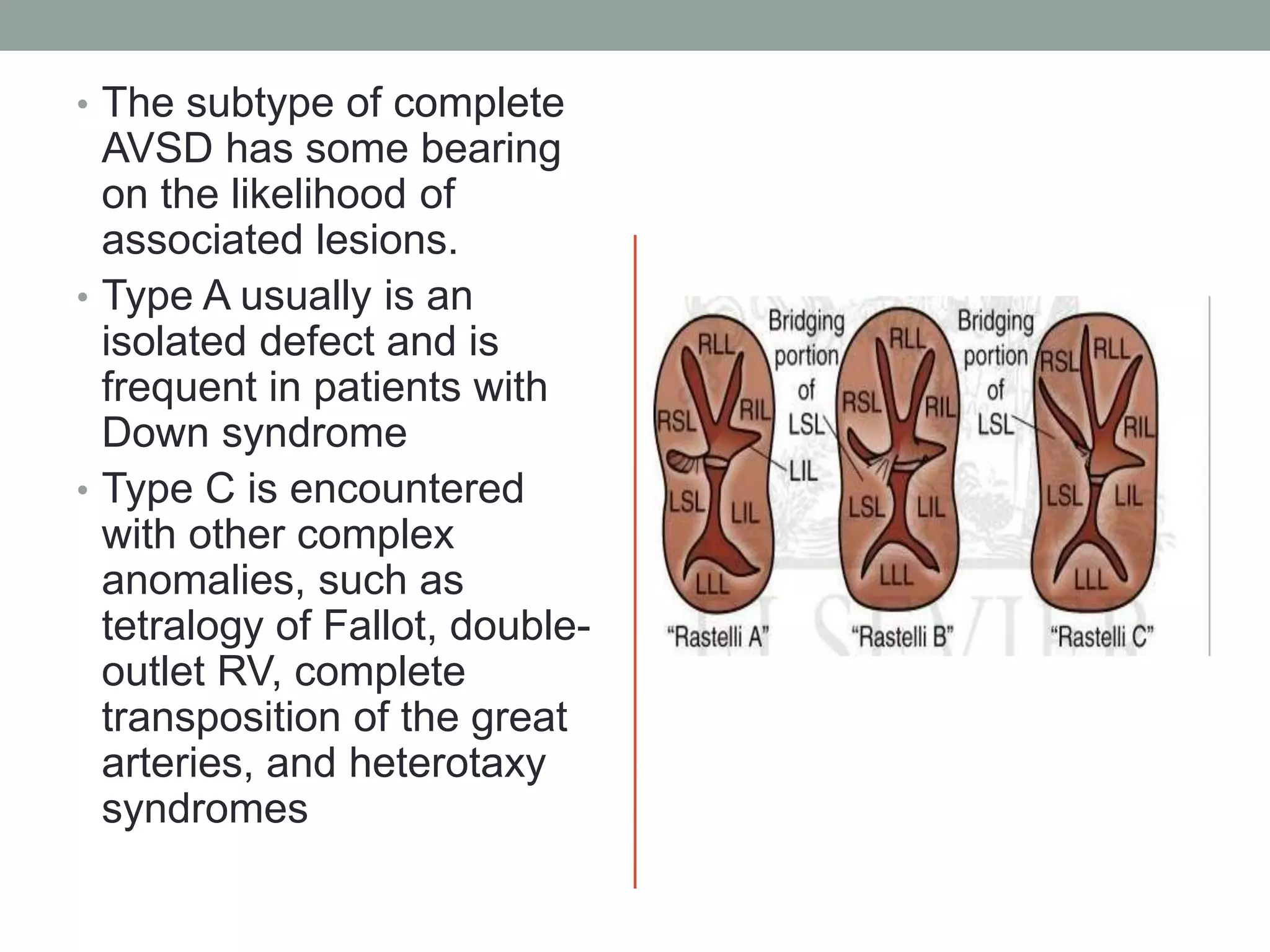 Atrioventricular septal defects | PPTX