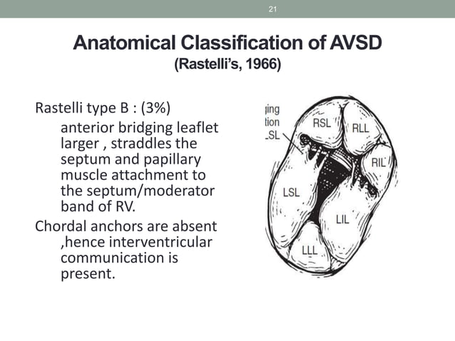 Atrioventricular septal defects | PPTX | Heart and Cardiovascular ...