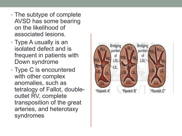 Atrioventricular septal defects | PPTX | Heart and Cardiovascular ...