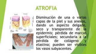 ATROFIA.pptx