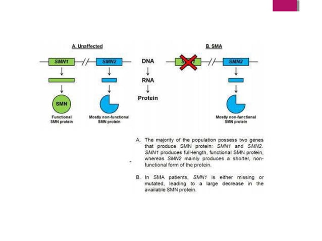 Atrofia muscular nutrición.pptx