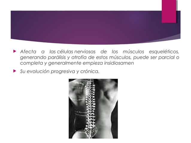 Atrofia muscular nutrición.pptx