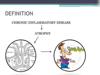 Atrophic rhinitis ppt | PPTX