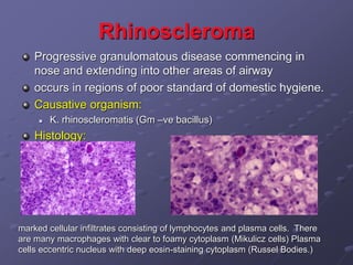 Atrophic rhinitis | PPT