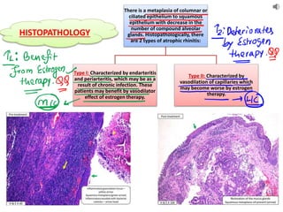 Atrophic rhinitis.pptx