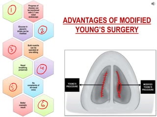 Atrophic rhinitis.pptx