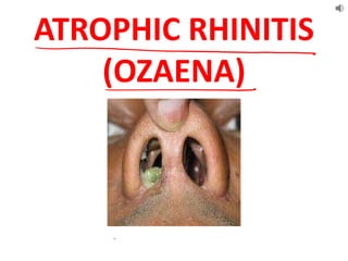 Atrophic Rhinitis