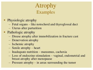 Atrophy | PPTX