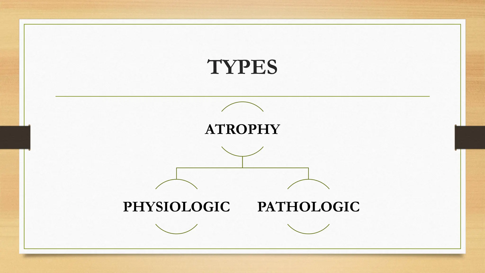 atrophy65856475646543643643543543643654.pptx