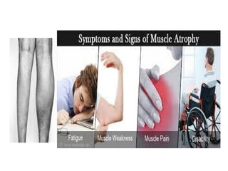 atrophy is a disorder of muscle shrinking. | PPT