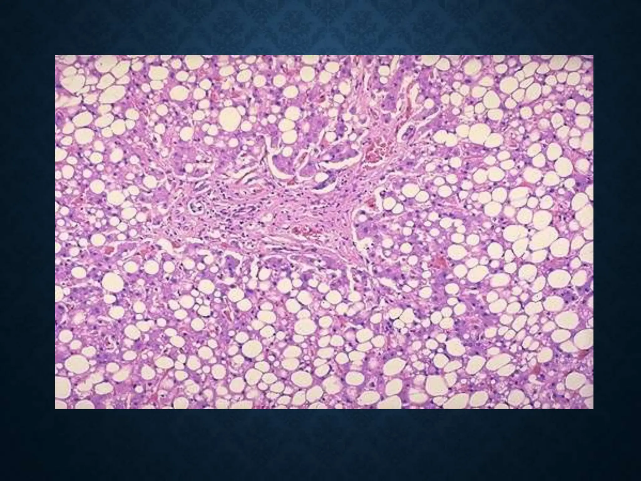 Atrophy and dystrophy-accumulation.ppt