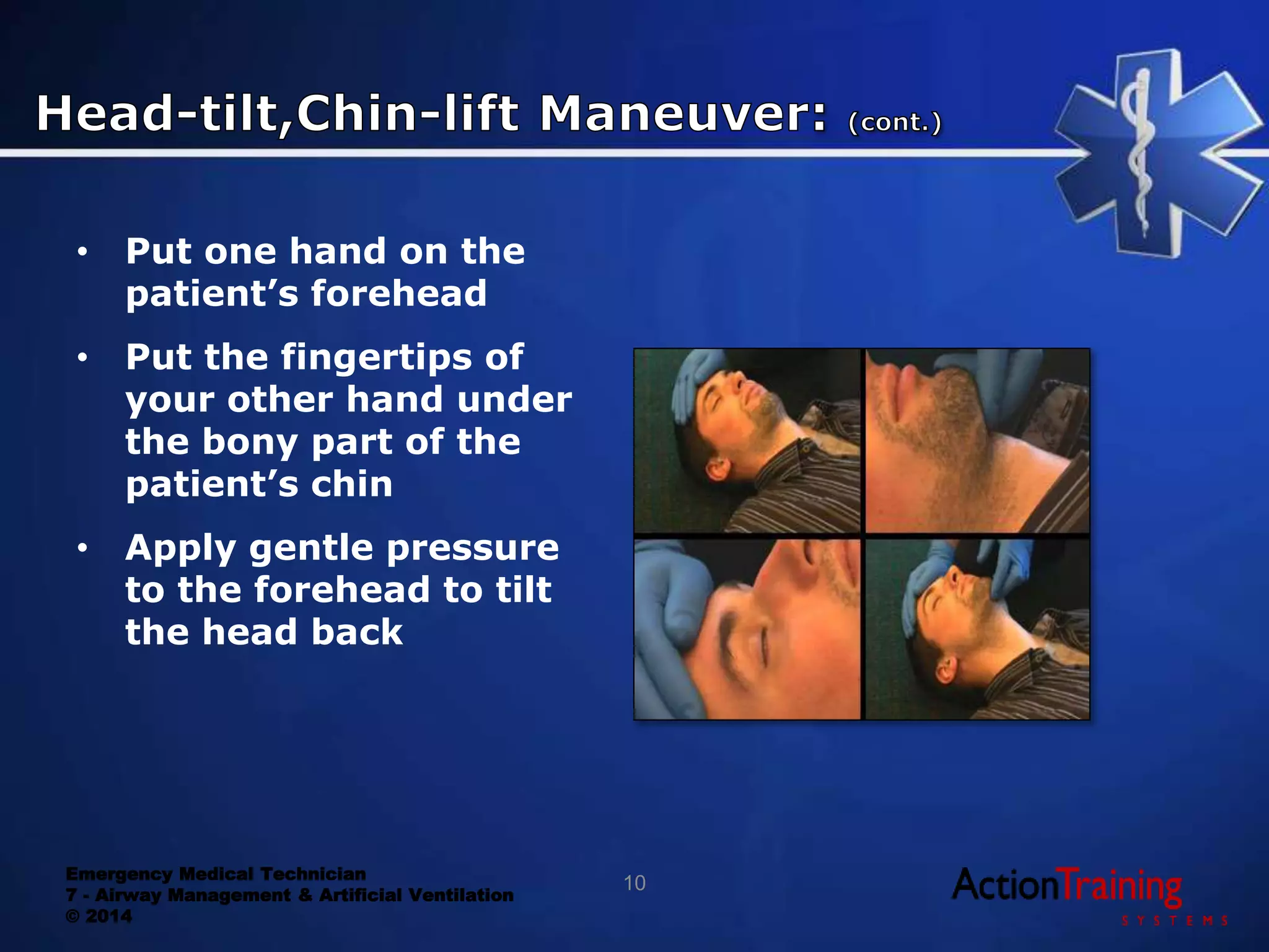 ATS - airway management | PPTX