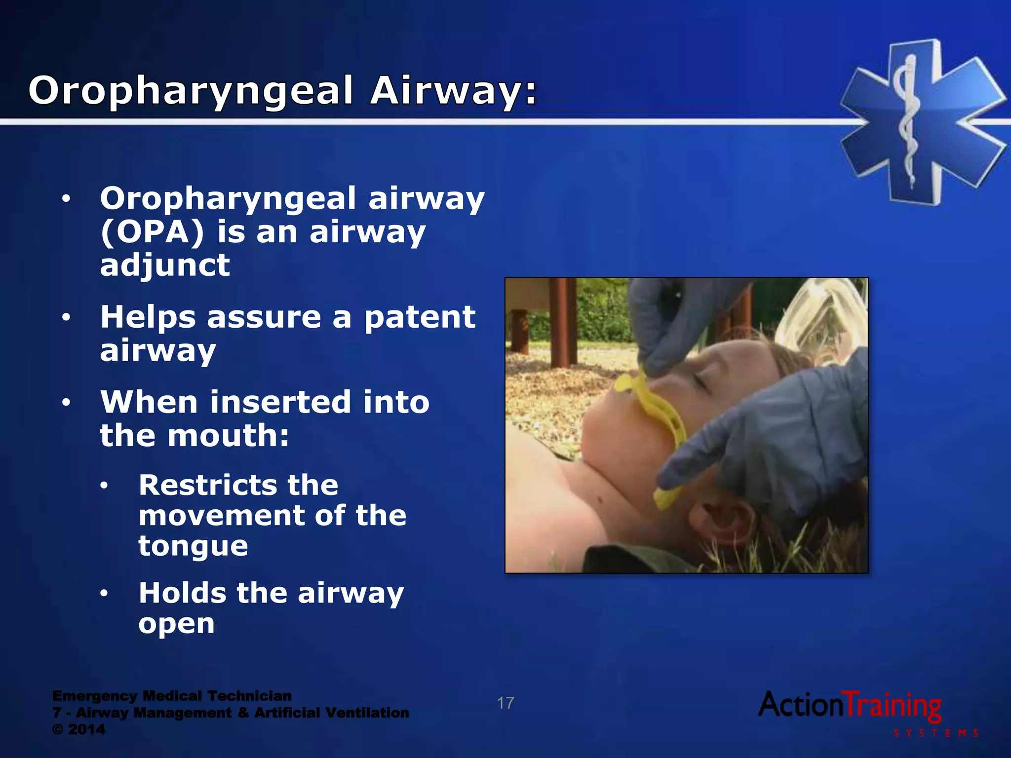 ATS - airway management | PPTX