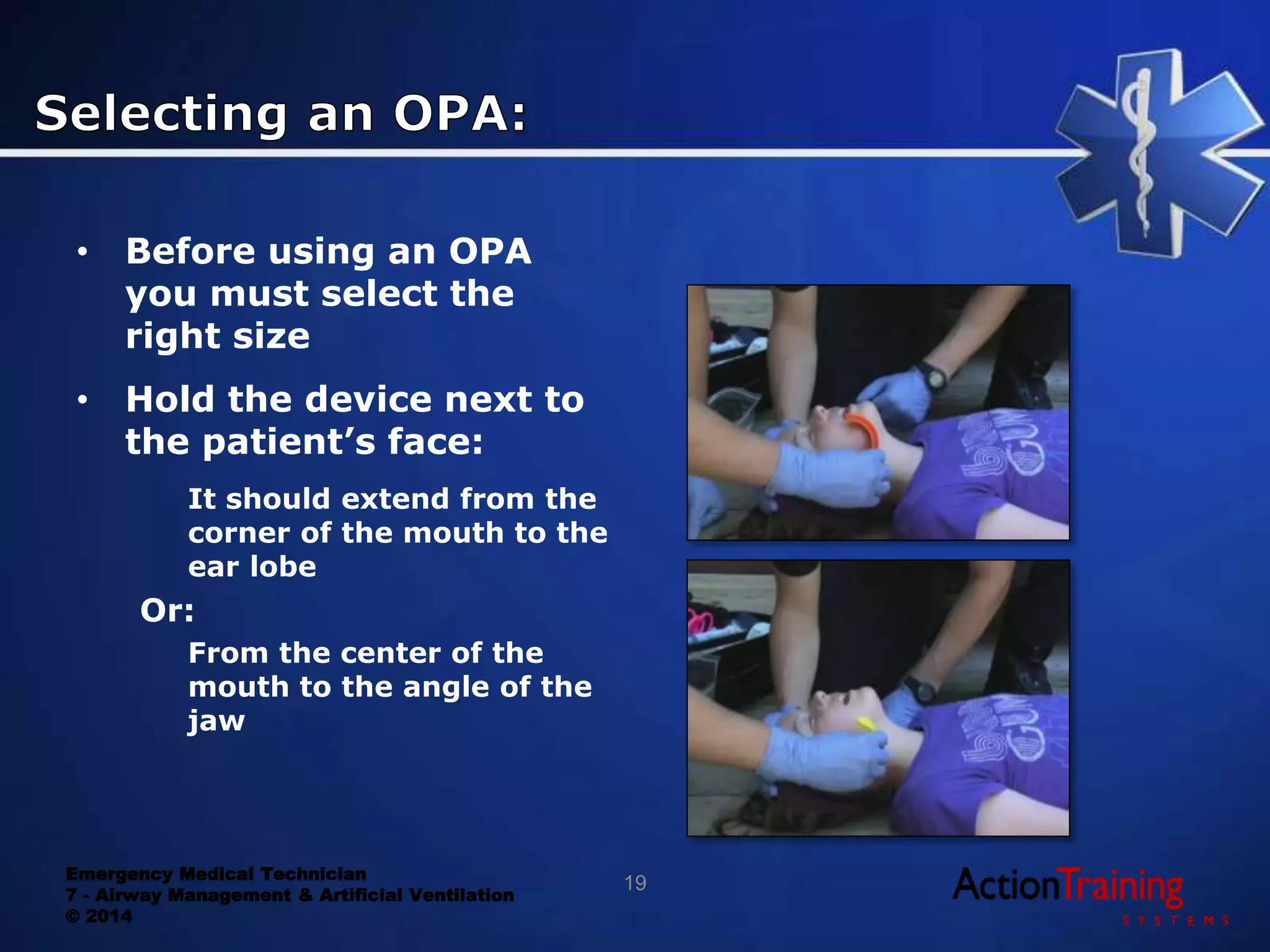 ATS - airway management | PPTX