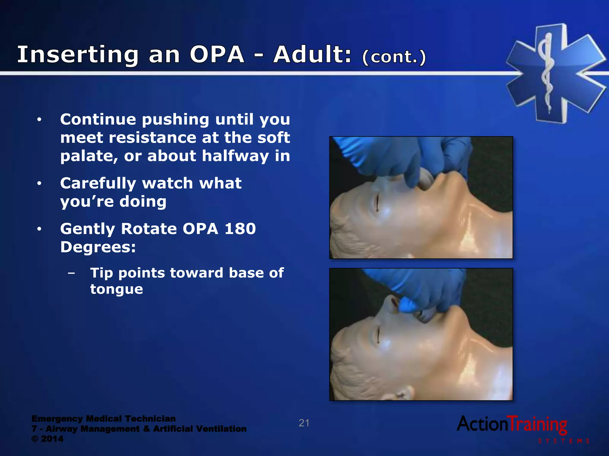 ATS - airway management | PPTX