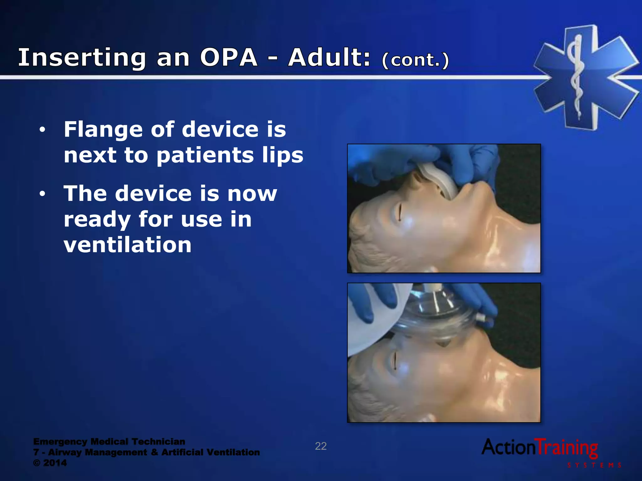 ATS - airway management | PPTX