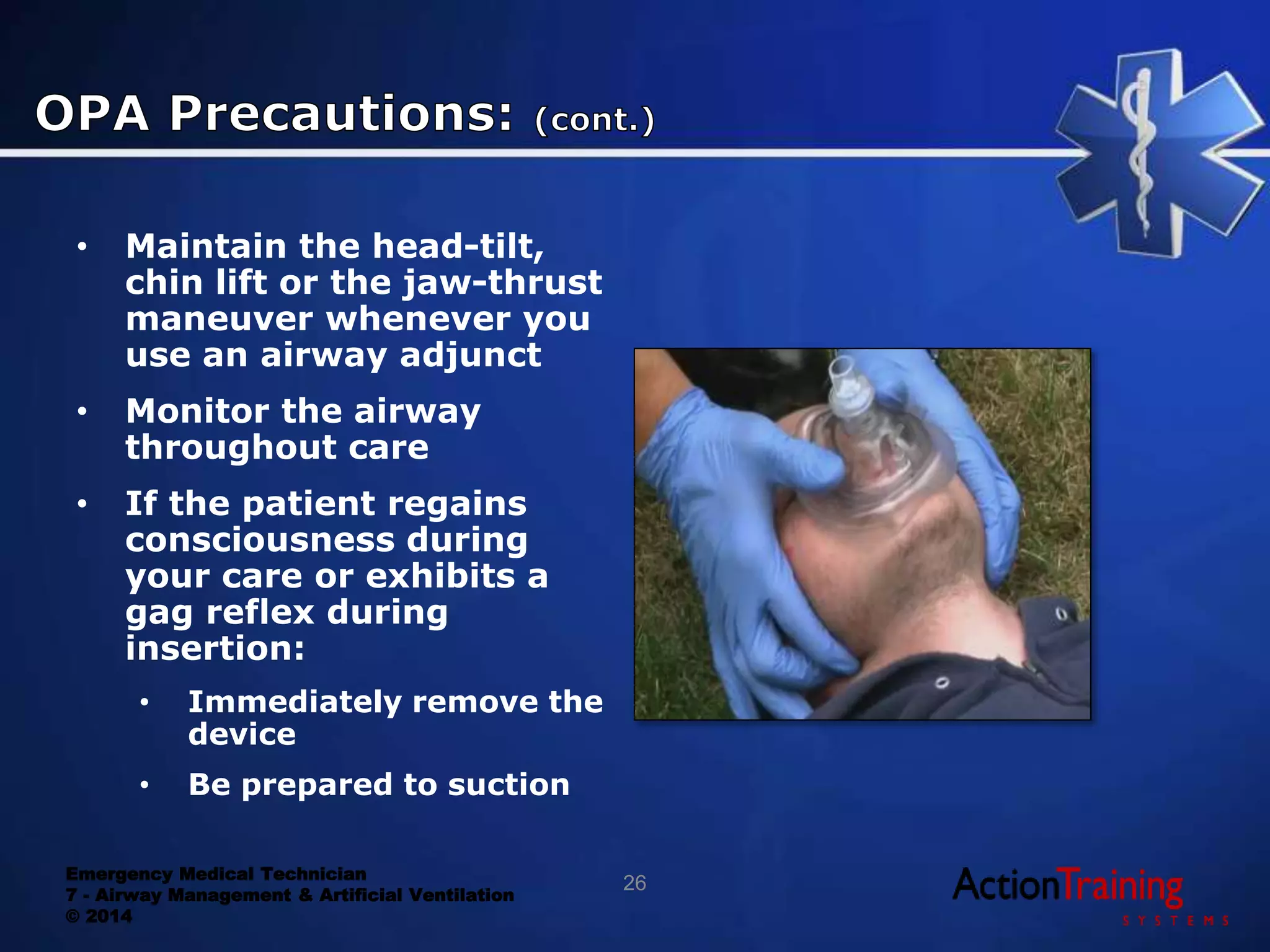 ATS - airway management | PPTX