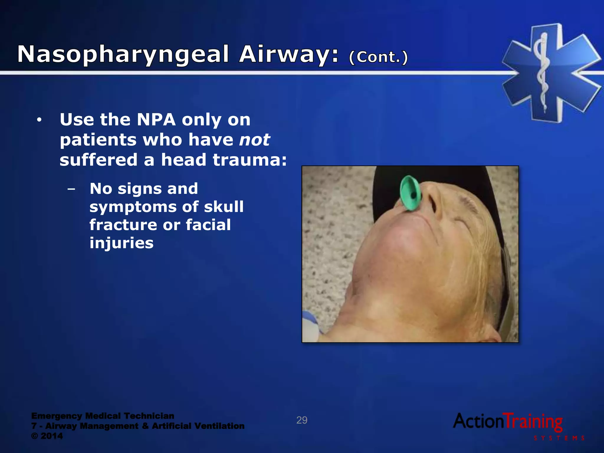 ATS - airway management | PPTX