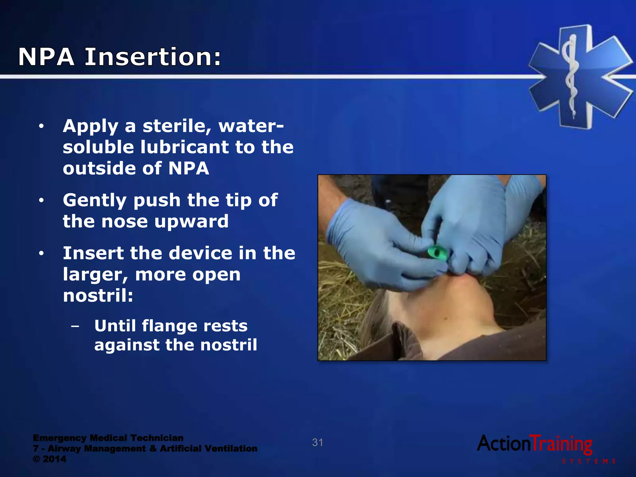 ATS - airway management | PPTX