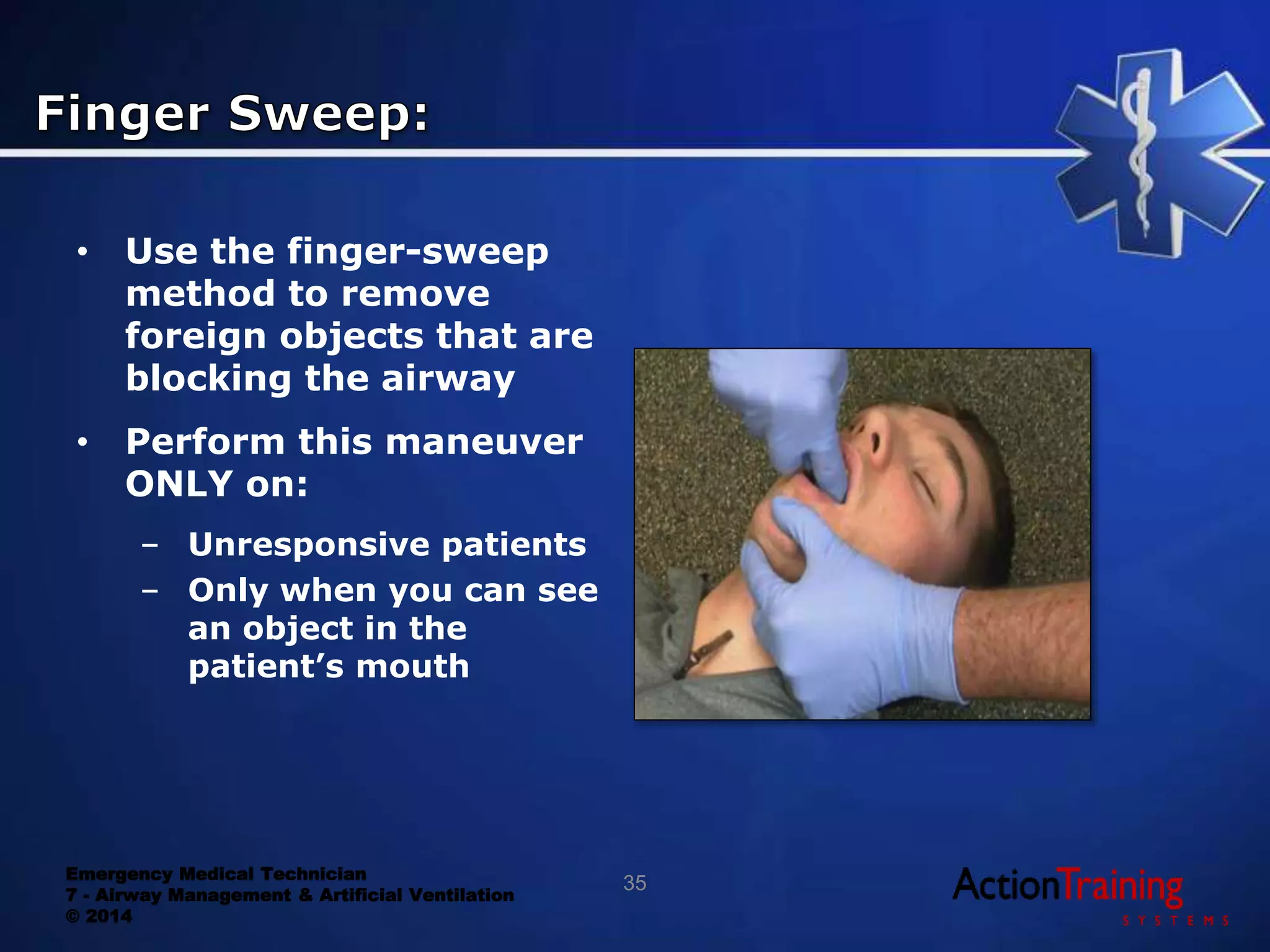 ATS - airway management | PPTX
