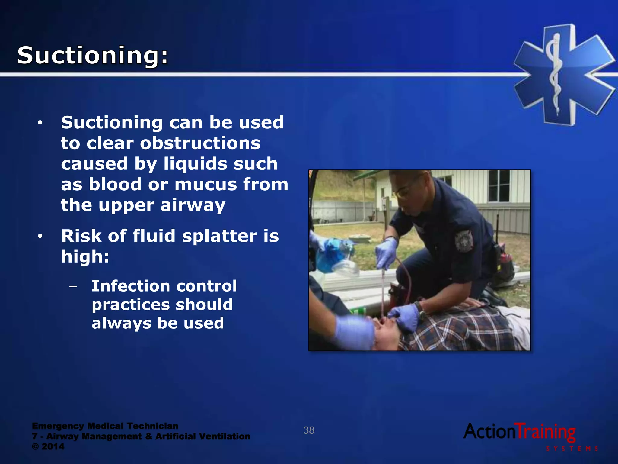 ATS - airway management | PPTX