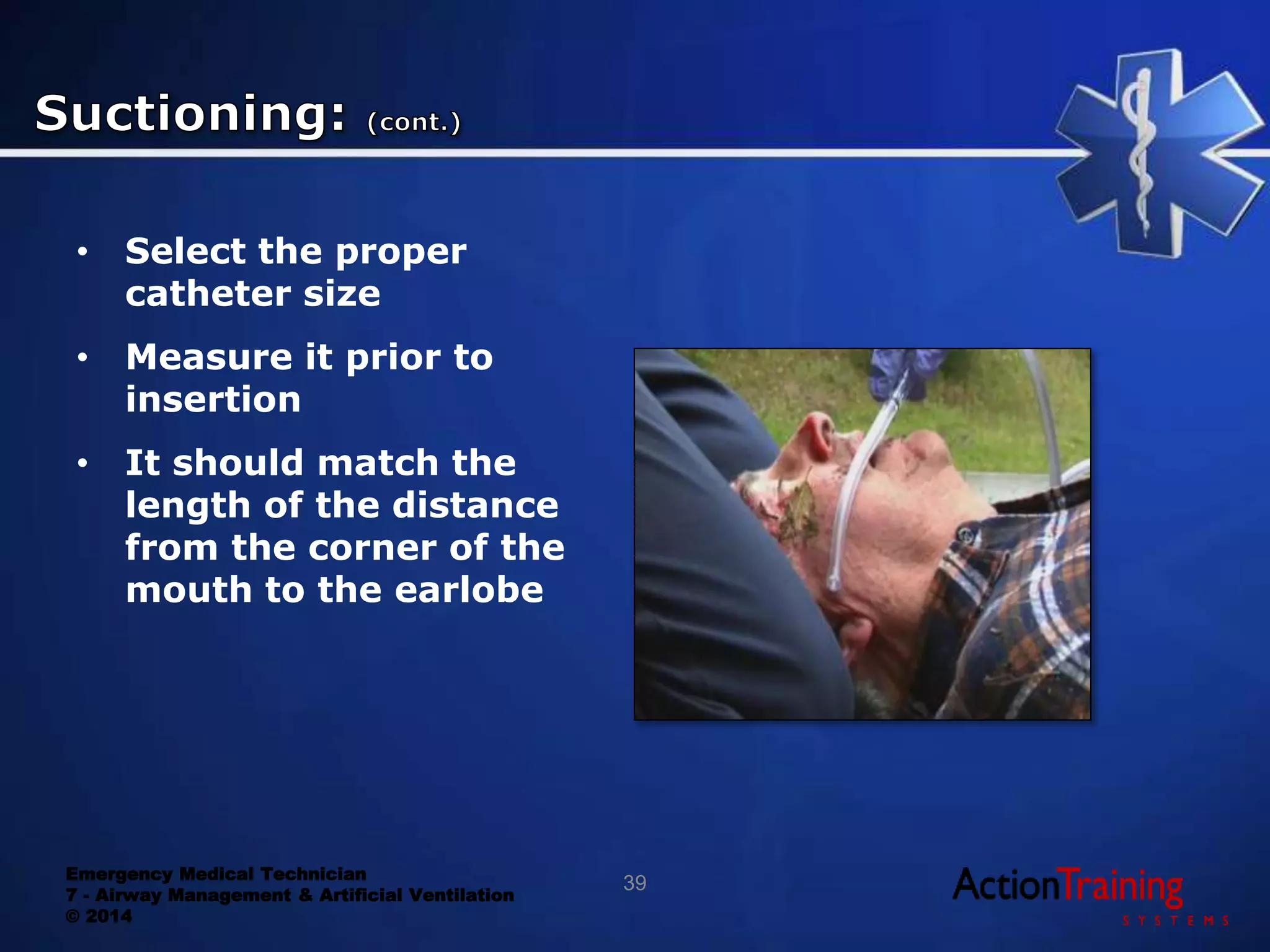 ATS - airway management | PPTX