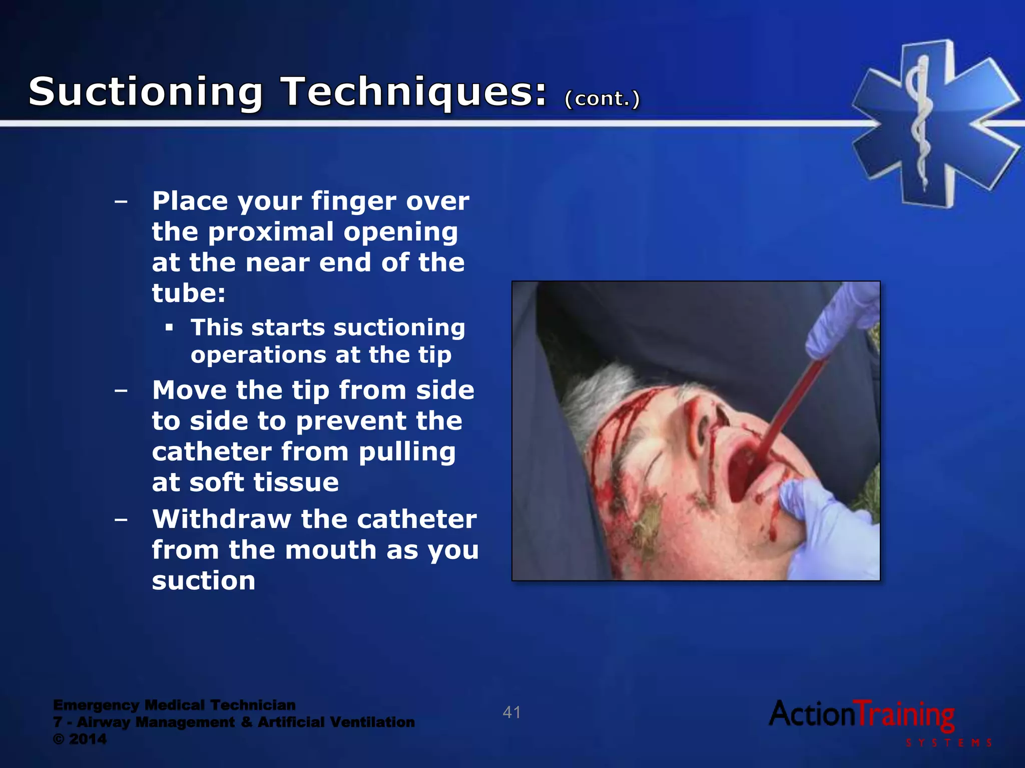 ATS - airway management | PPTX