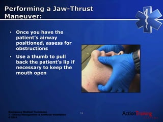 ATS - airway management | PPTX