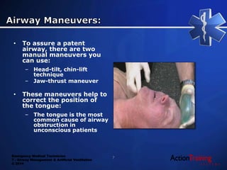 ATS - airway management | PPTX