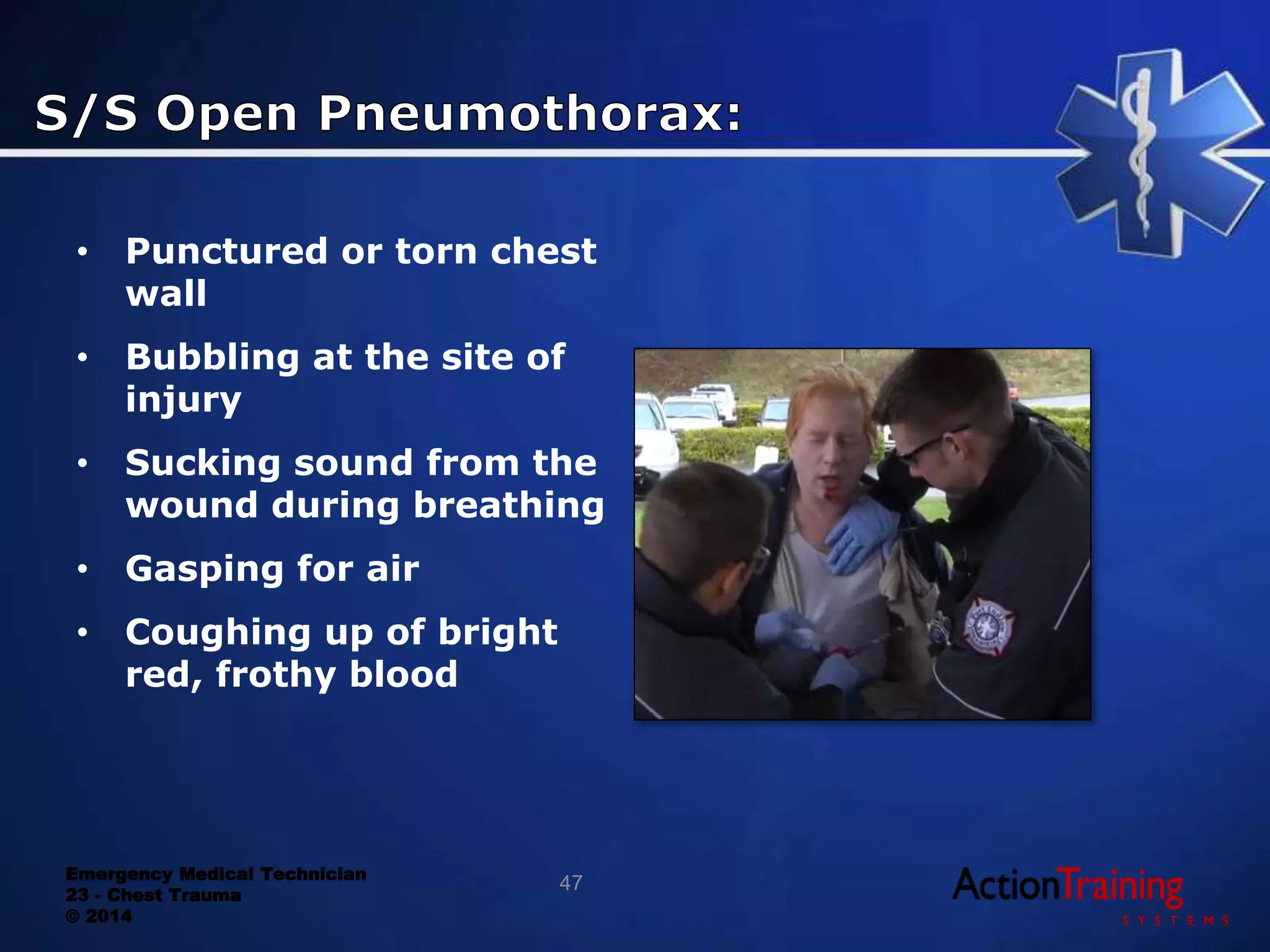 ATS - chest trauma | PPT