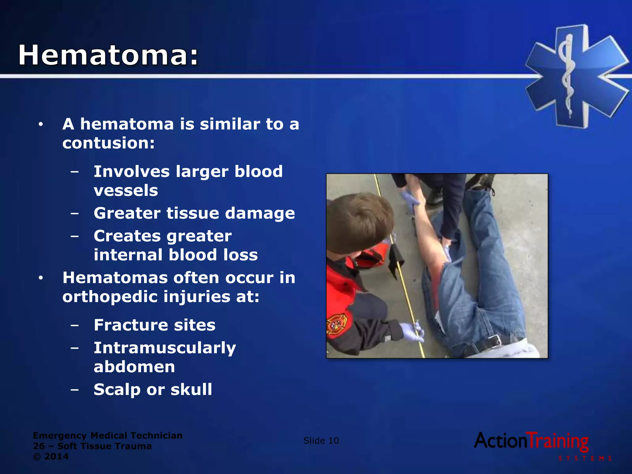 ATS - soft tissue trauma | PPTX