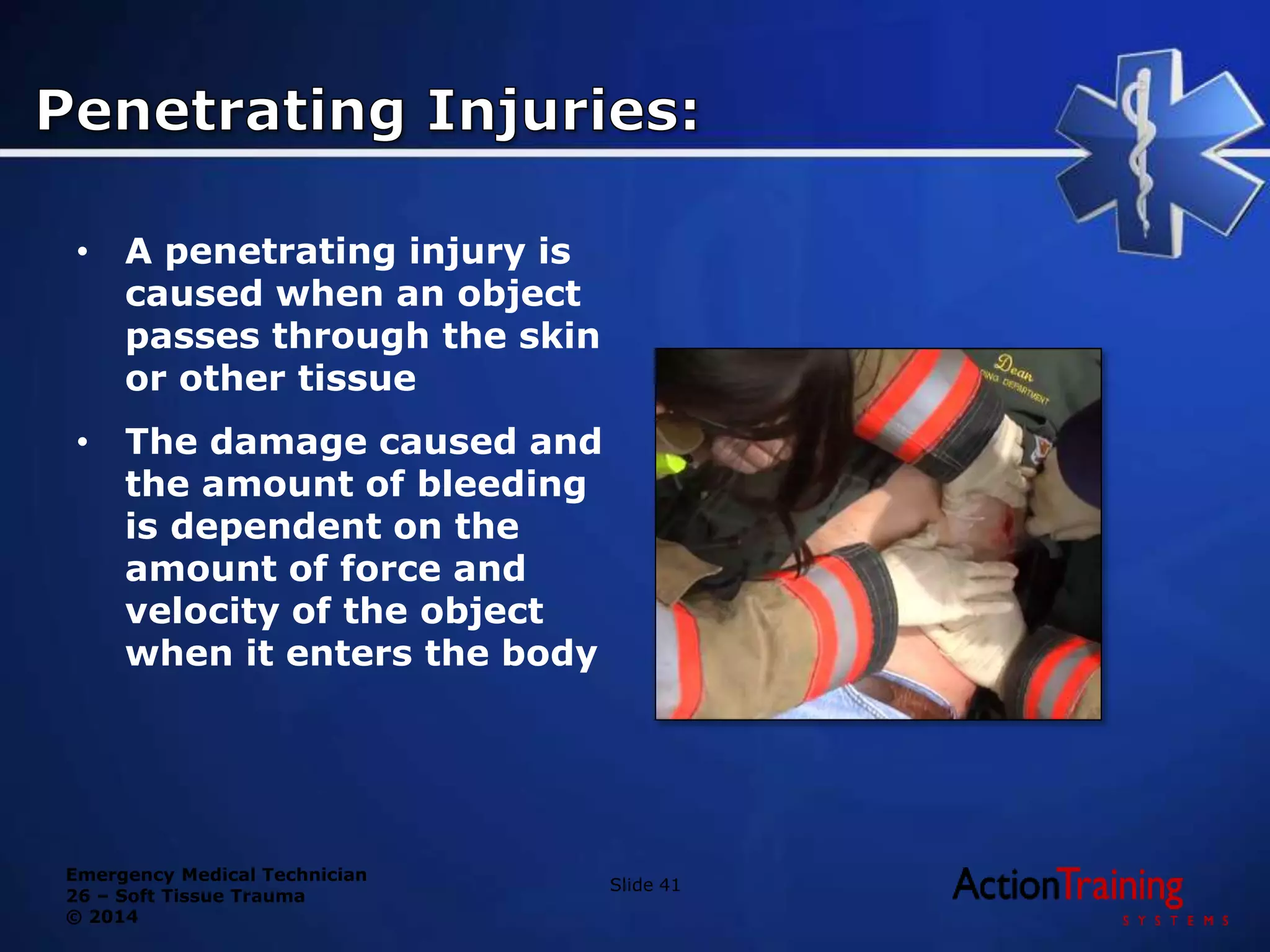 ATS - soft tissue trauma | PPTX