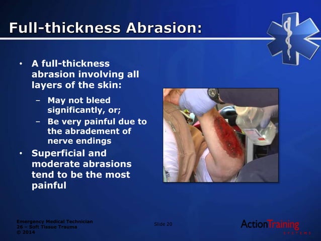 ATS - soft tissue trauma | PPTX