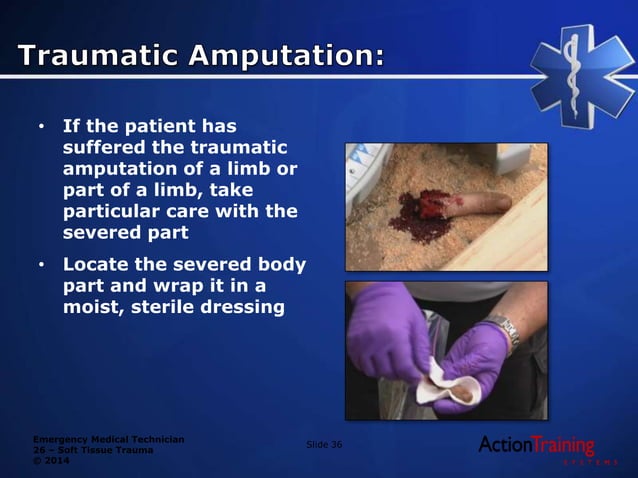 ATS - soft tissue trauma | PPTX