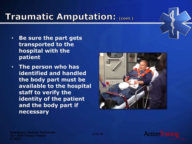 ATS - soft tissue trauma | PPTX