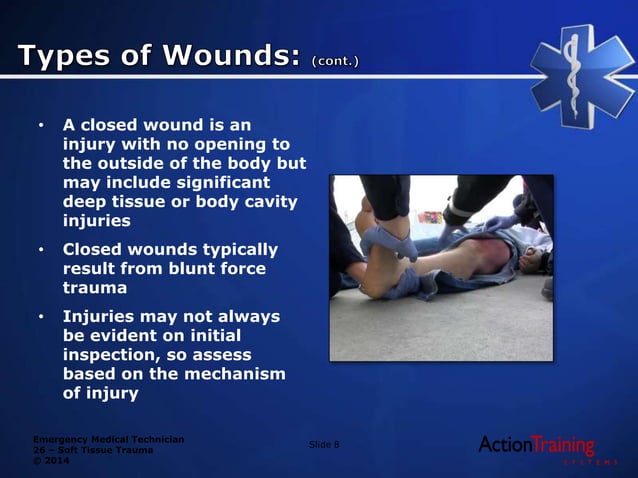 ATS - soft tissue trauma | PPTX