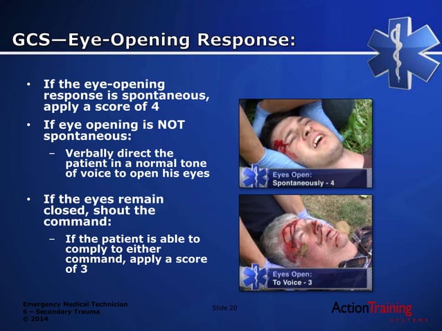ATS - secondary trauma | PPTX | First Aid | Injuries