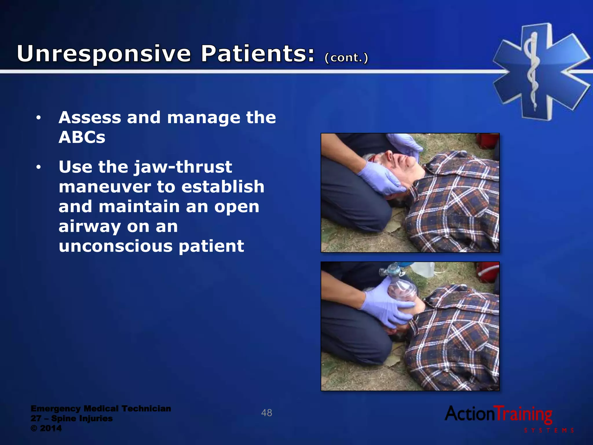 ATS - spine injuries | PPTX