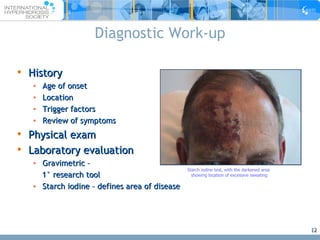 Hyperhidrosis Hyperhidrosis | PPT