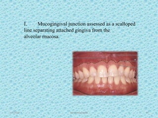 Mucogingival Junction