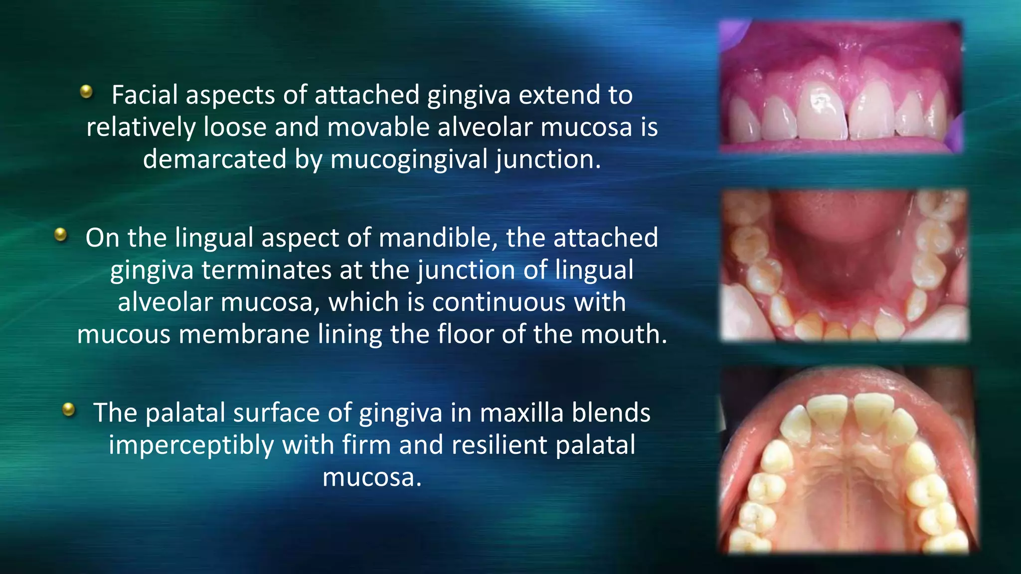 Attached gingiva and its significance | PPTX