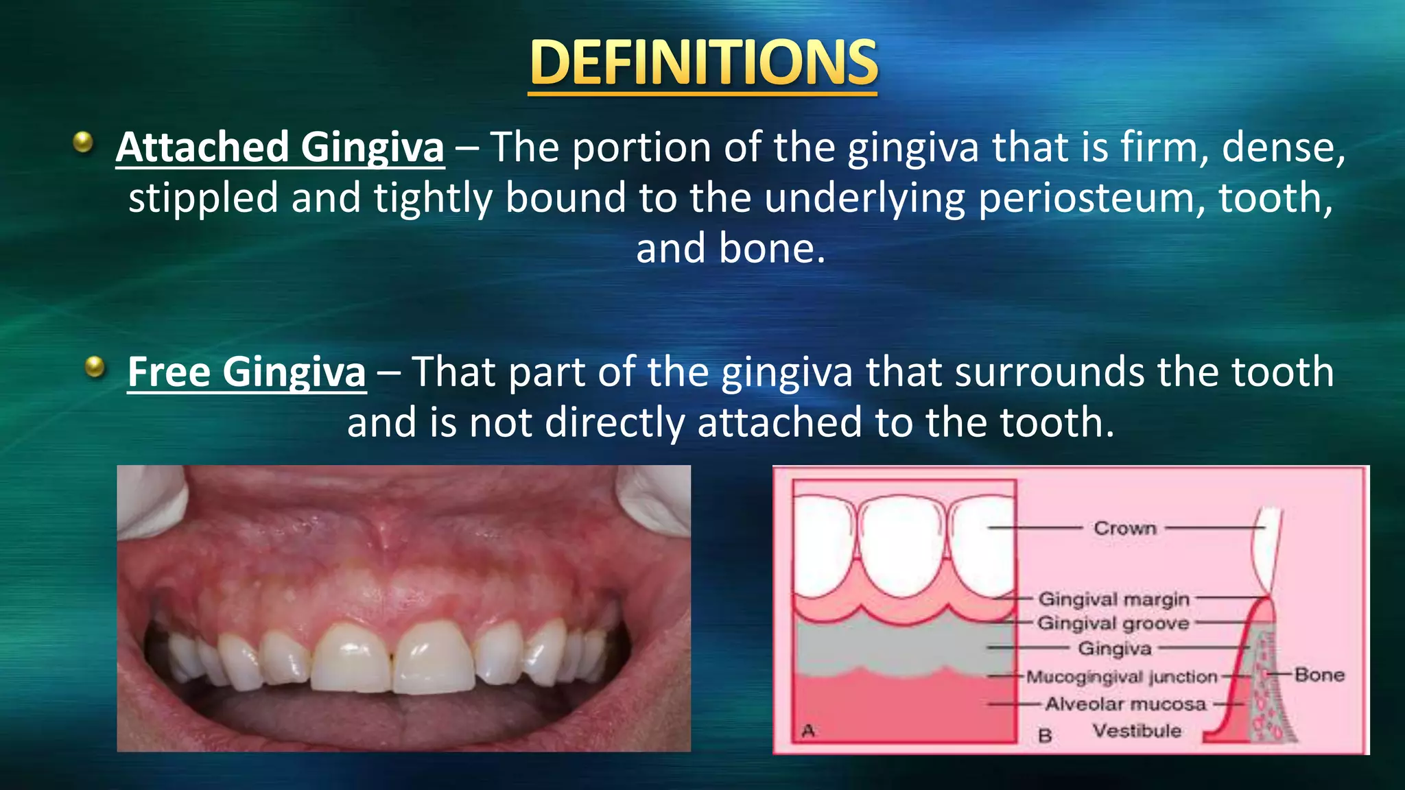 Attached gingiva and its significance | PPTX