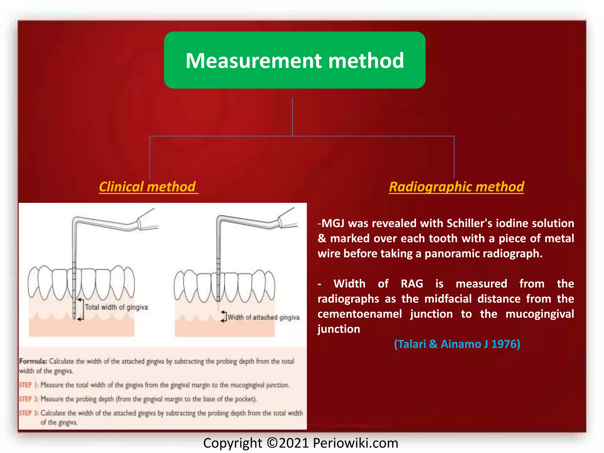 Attached gingiva and procedures for gingival augmentation | PPTX
