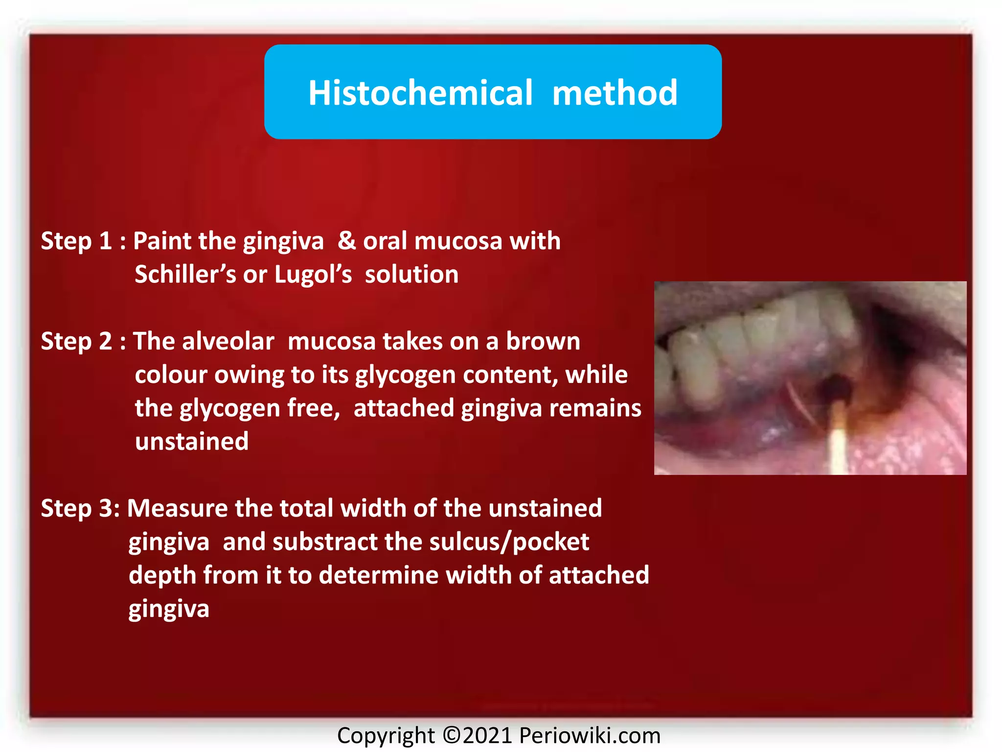Attached gingiva and procedures for gingival augmentation | PPTX