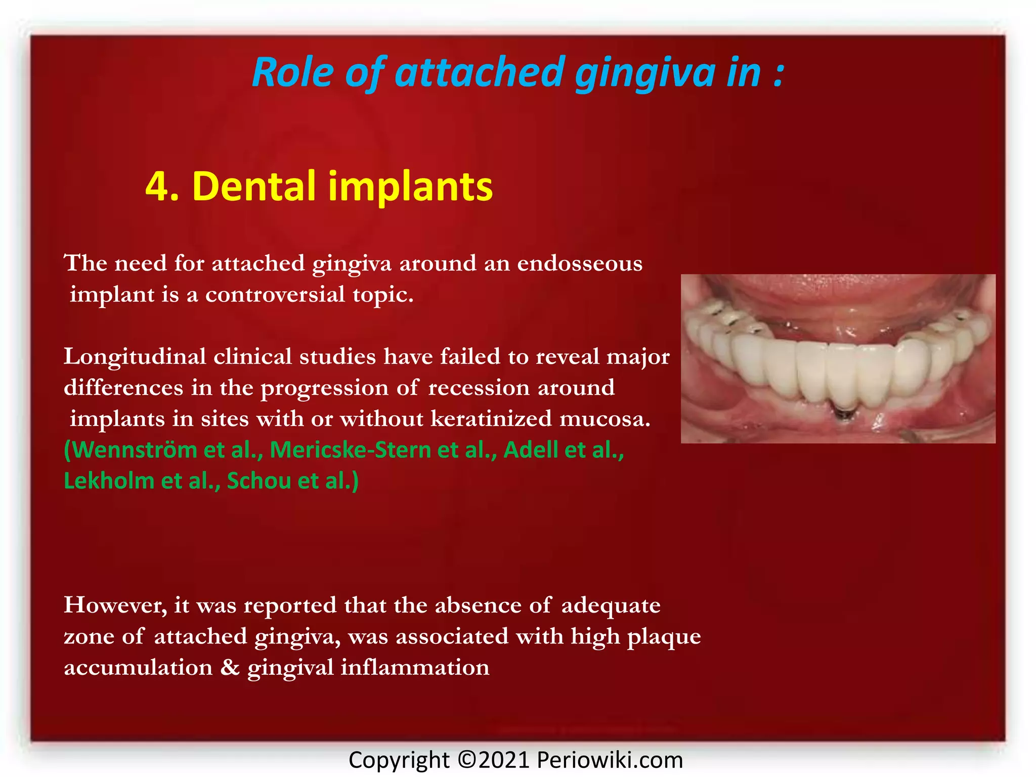 Attached gingiva and procedures for gingival augmentation | PPTX