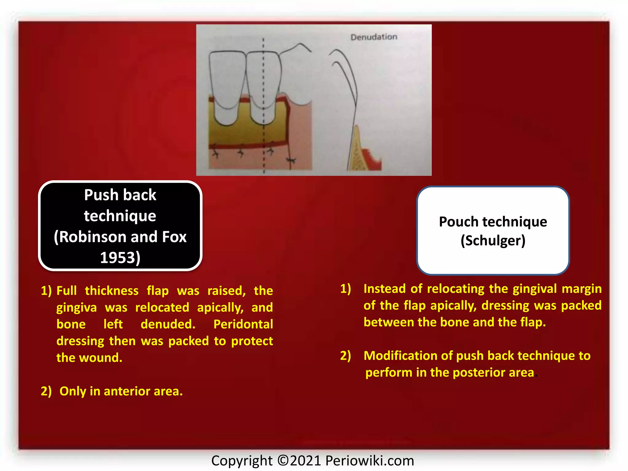 Attached gingiva and procedures for gingival augmentation | PPTX