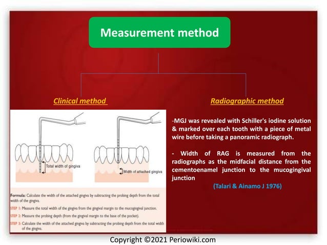 Attached gingiva and procedures for gingival augmentation | PPTX | Oral ...