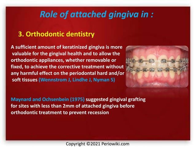 Attached gingiva and procedures for gingival augmentation | PPTX | Oral ...
