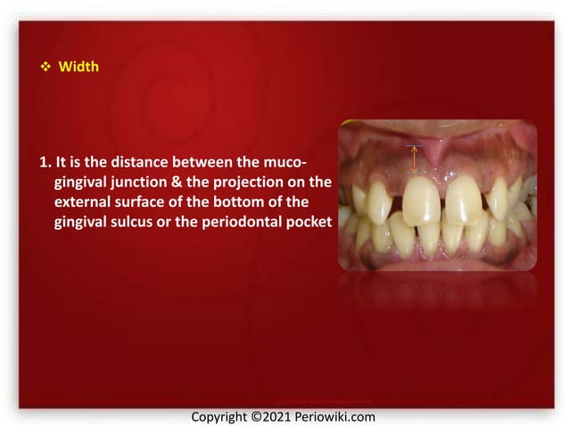 Attached gingiva and procedures for gingival augmentation | PPTX | Oral ...